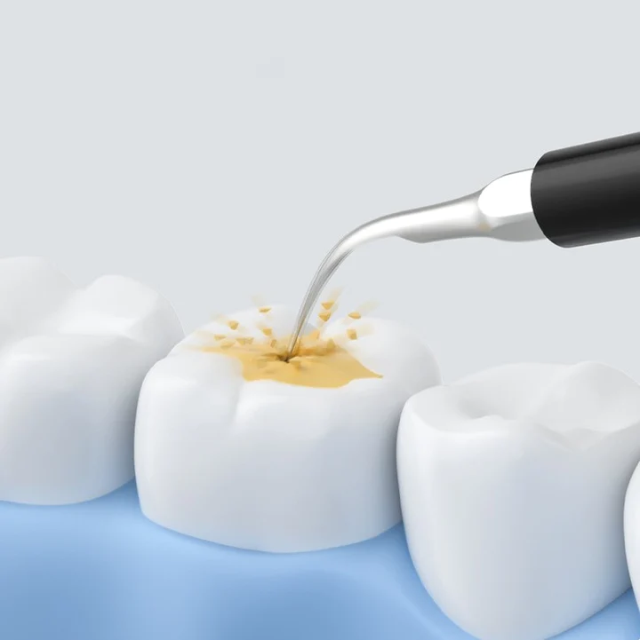Ultra Smooth Electric Teeth Cleaner™ | Tandrengöringssats – Monairo.se